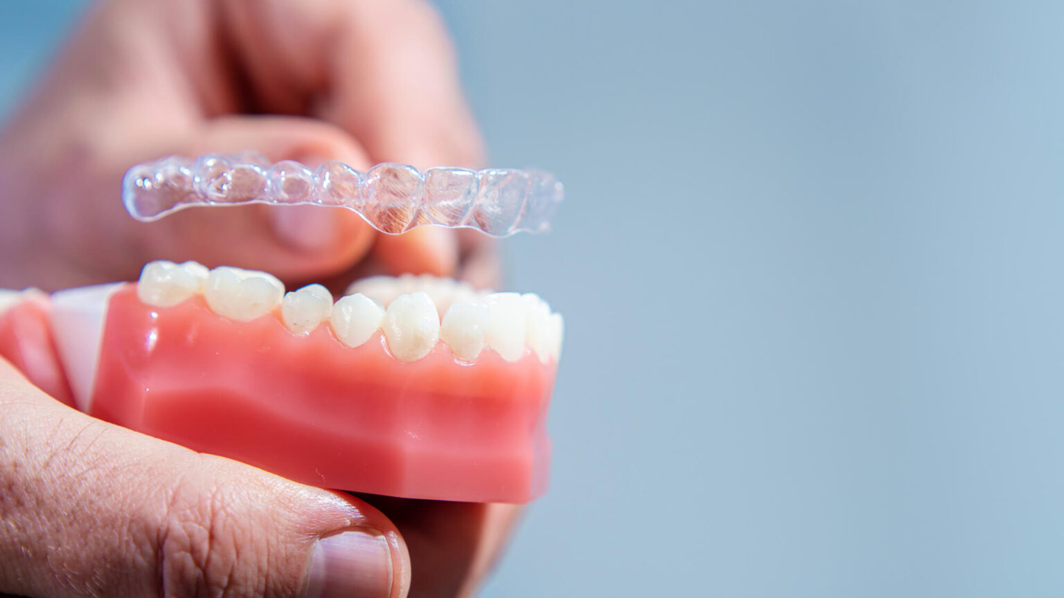 Guide to Transparent Braces: Benefits, Costs, and Care Tips